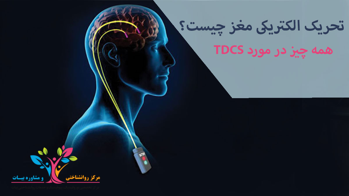 تحریک الکتریکی مغز Tdcs چیست؟ مرکز روانشناسی و لورتا نوروفیدبک بیات